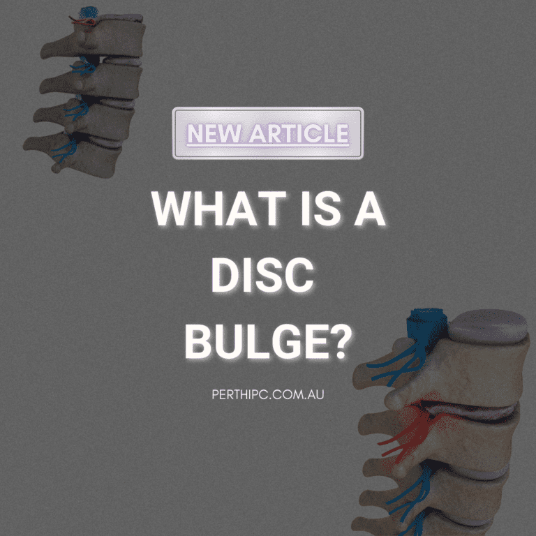 What Is A Disc Bulge? - Perth Injury & Pain Clinic